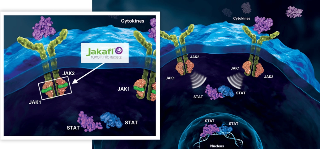 Mechanism of action of Jakafi in the treatment of patients with cGVHD ...